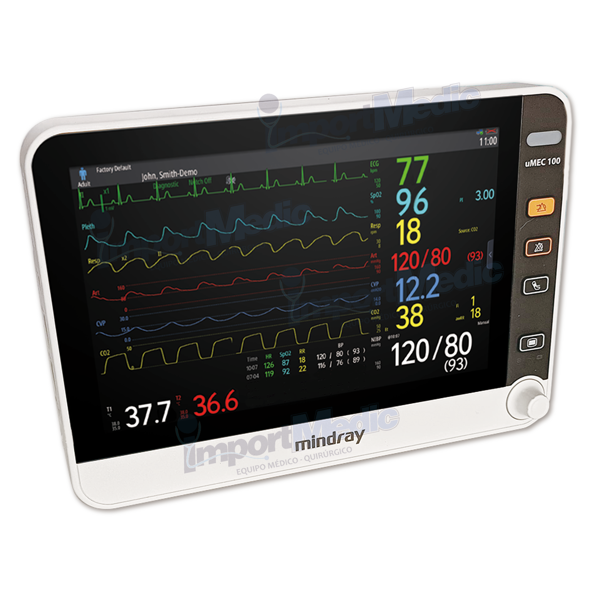 MONITOR DE SIGNOS VITALES MINDRAY uMEC 100 - Proveedora De Salud Total ...